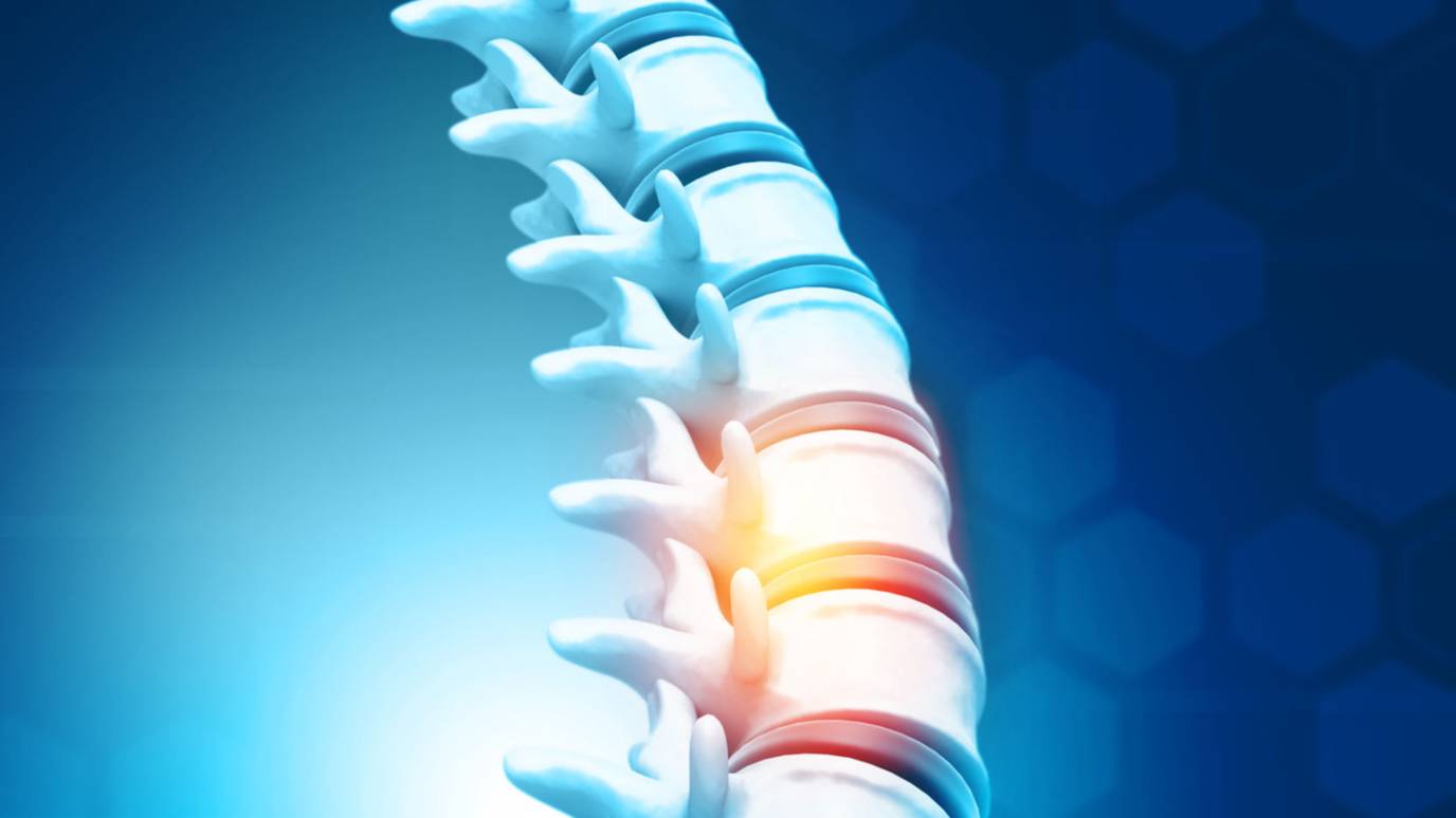 New Study Reveals Significant Reduction in Lumbar Spine Reoperation ...