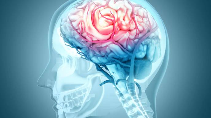 Shining a Light on the Hidden Damage of Mild Brain Injuries - - Global ...