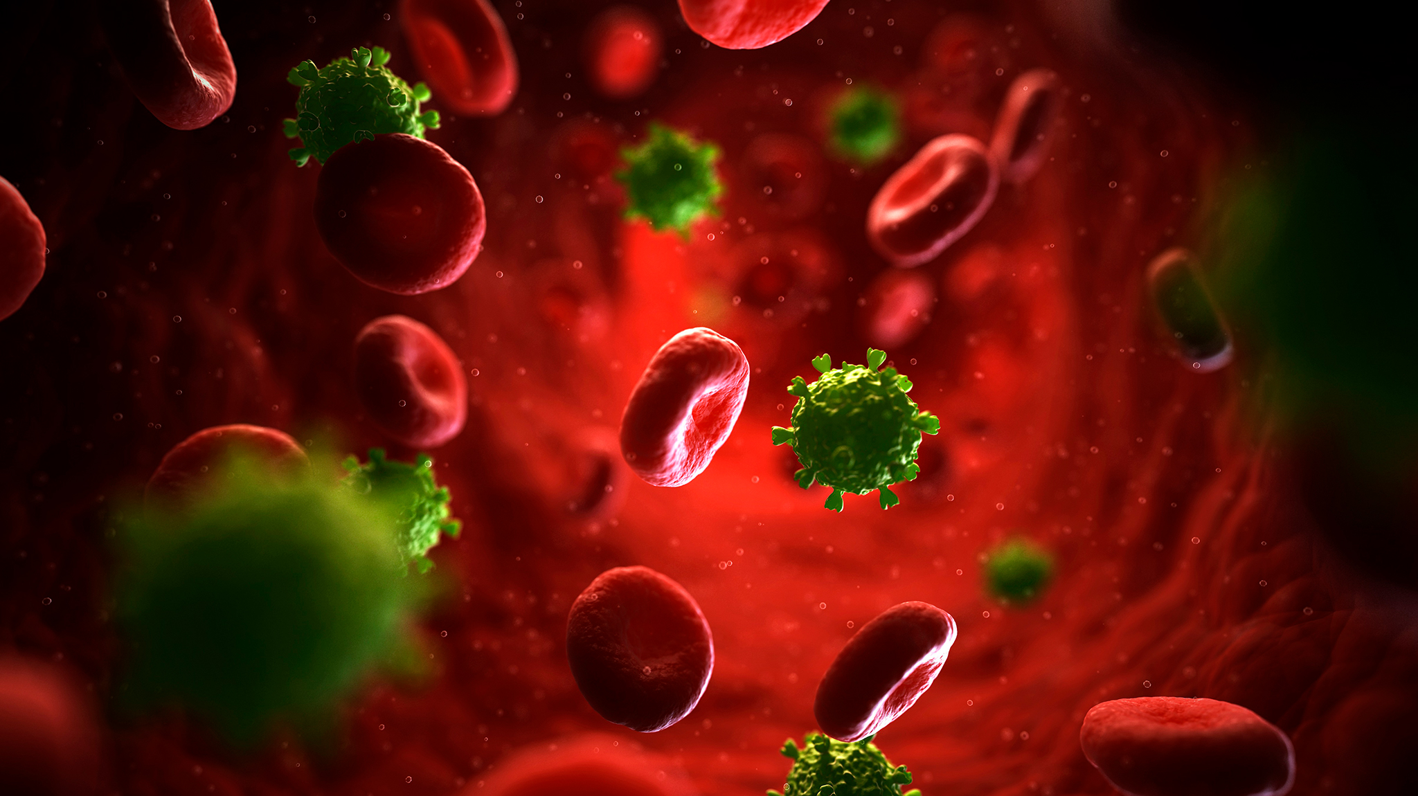 HIV AIDS And Infectious Disease Global Neurology Academy