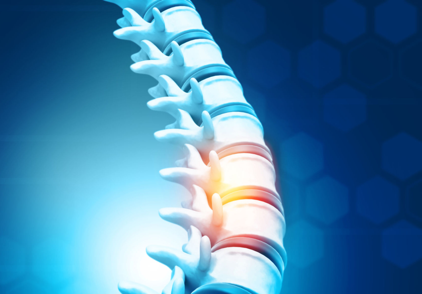 New Study Reveals Significant Reduction in Lumbar Spine Reoperation ...