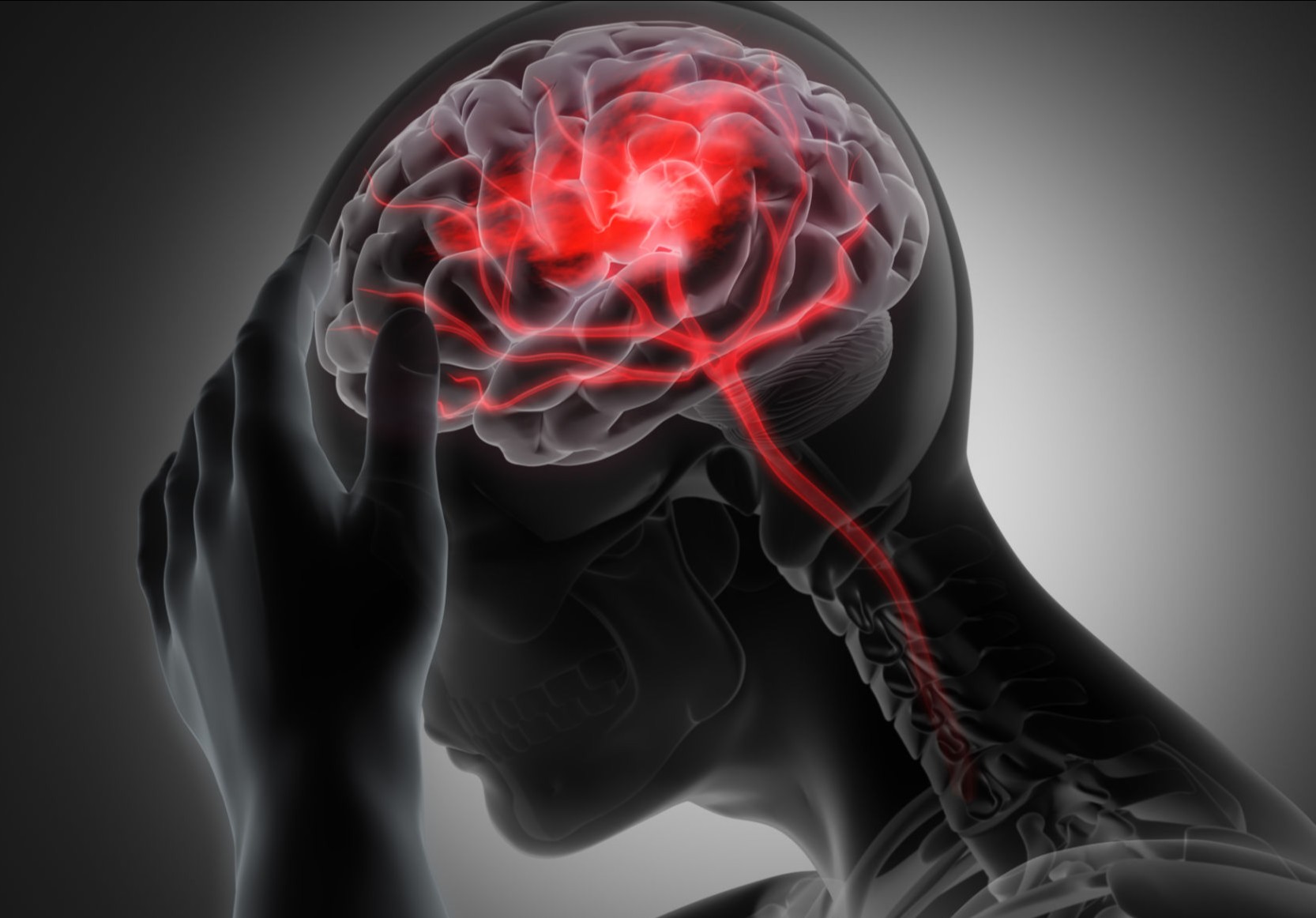 Brain Scans May Predict Chronic Pain Risk After Whiplash Injury ...